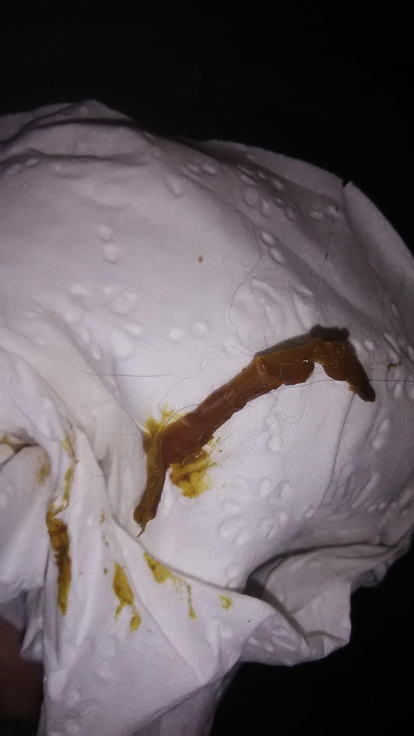 My Dog Passed a Long, Segmented Worm: What Is It & What To Do? | Petco