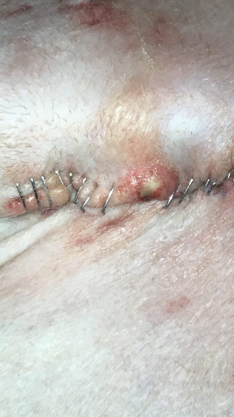 My Dog's Neuter Incision Is Puffy or Swollen. Should I Worry? | Petco