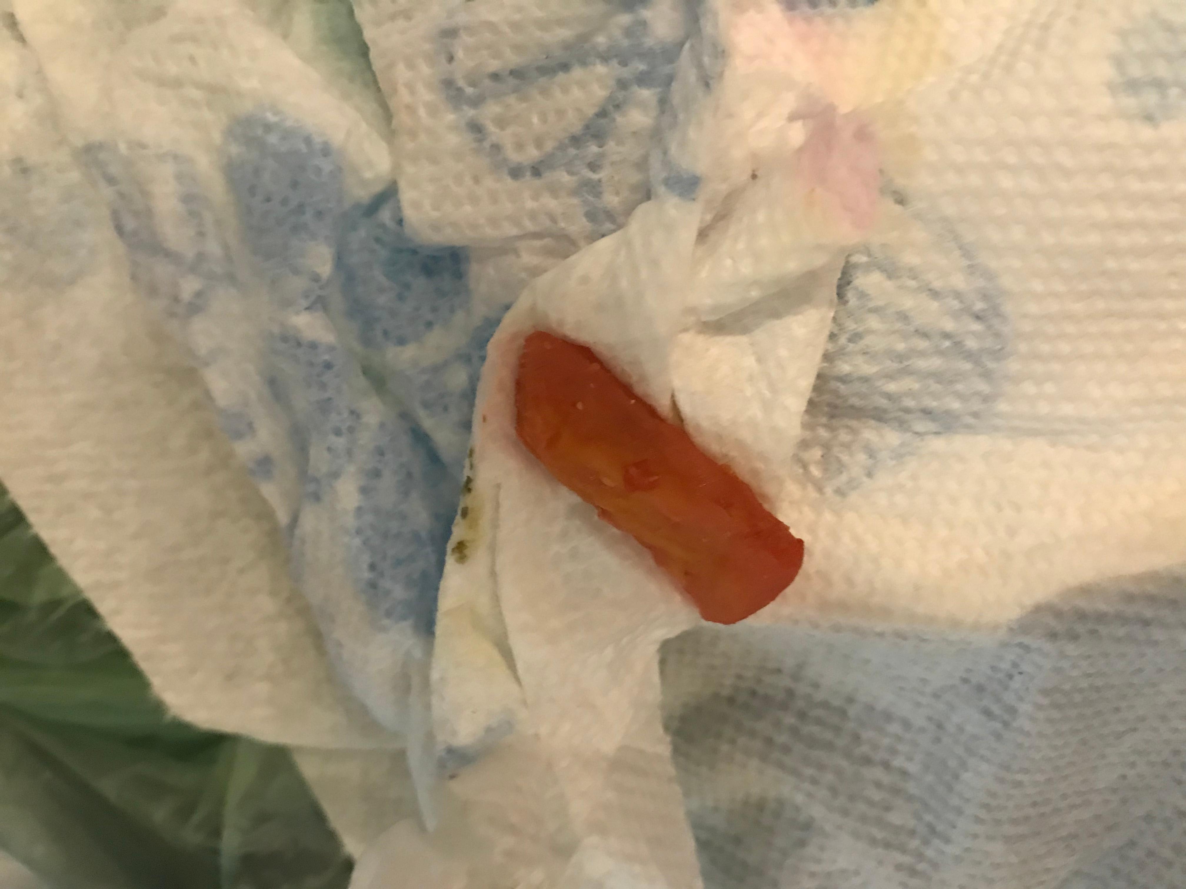 My Dog Vomited Orange Pineapple & Has Black Poop. Serious? | Petco