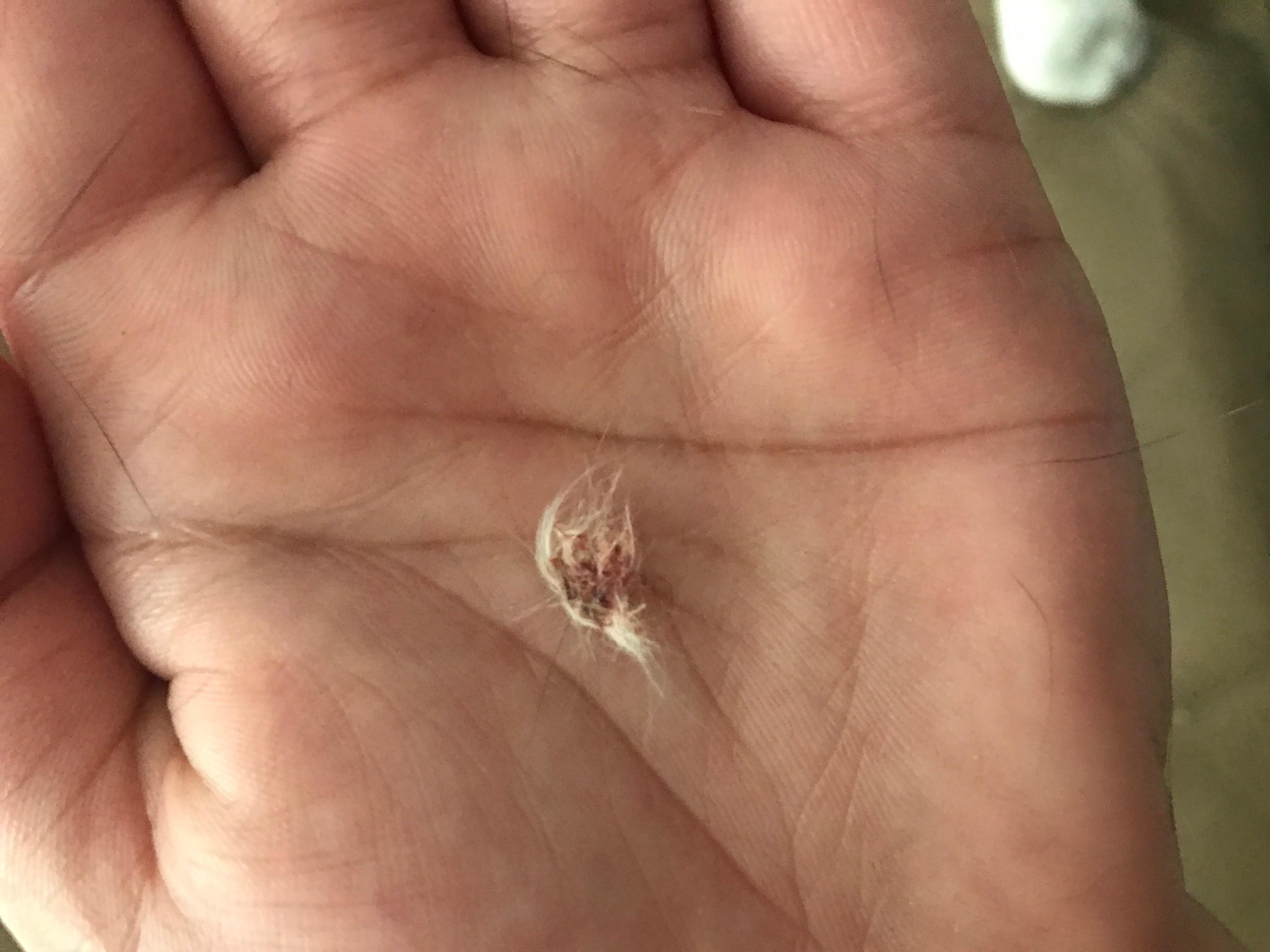 My cat has a bloody, scabby wound on her neck. Is it infected? | Petco