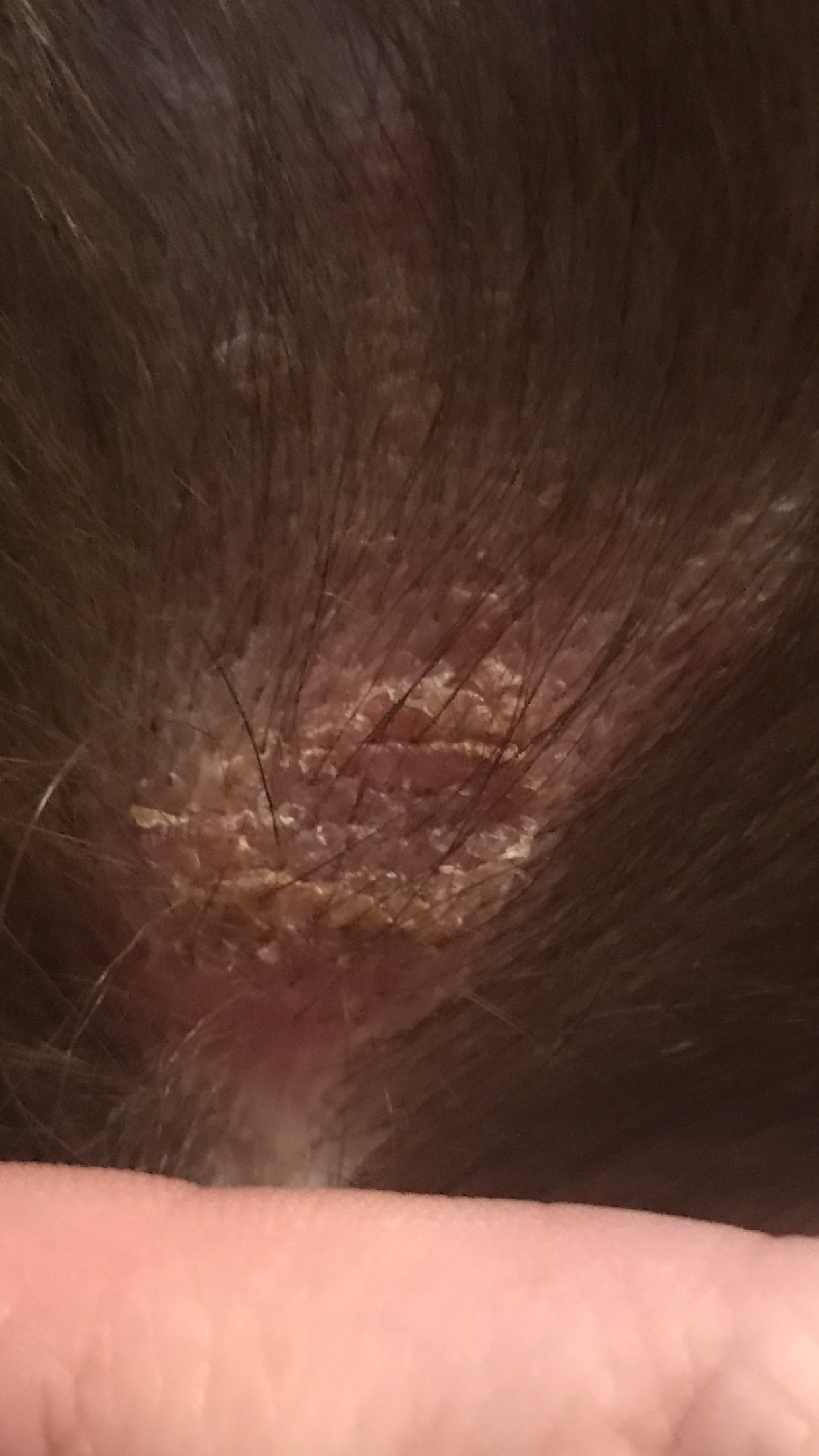 Why does your dog have scaly, flaky skin & lick spots? Learn more | Petco