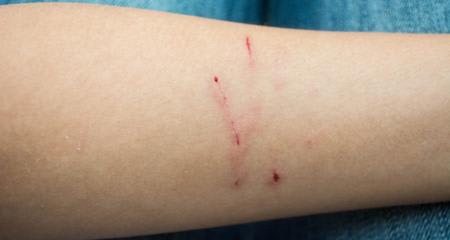 Treating Pet Scratches at Home: A Guide | Petco