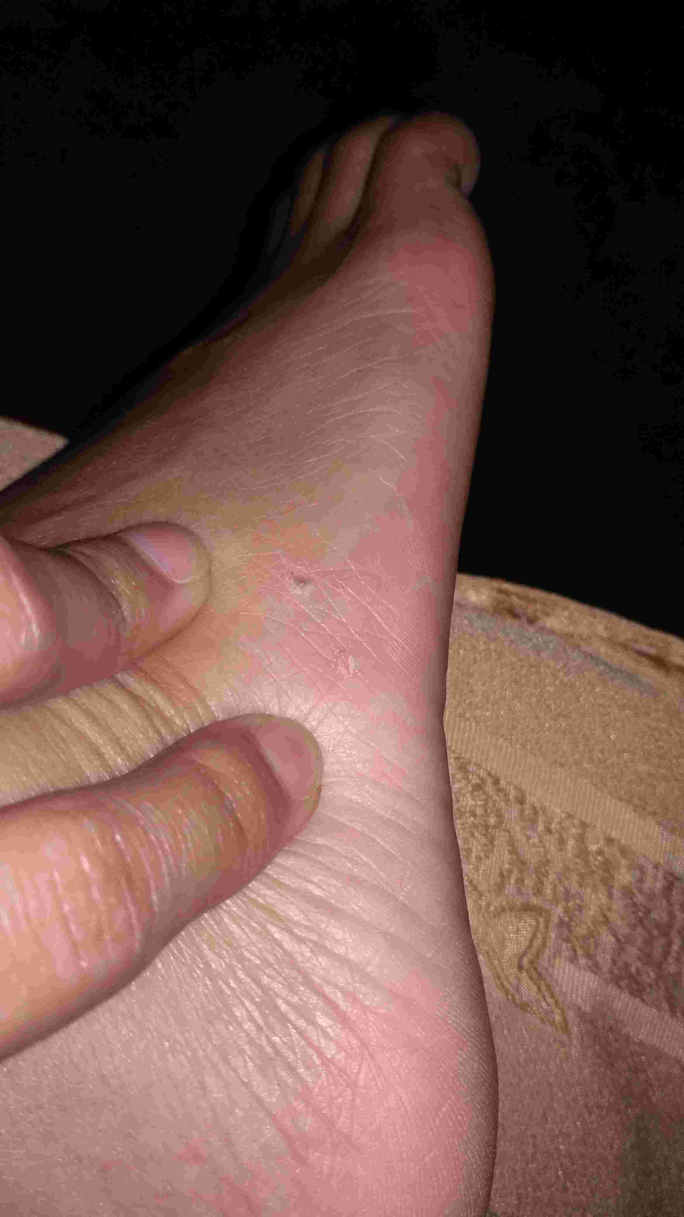 If a Stray Cat Scratches You: Is it Rabies or Cat Scratch Disease? | Petco