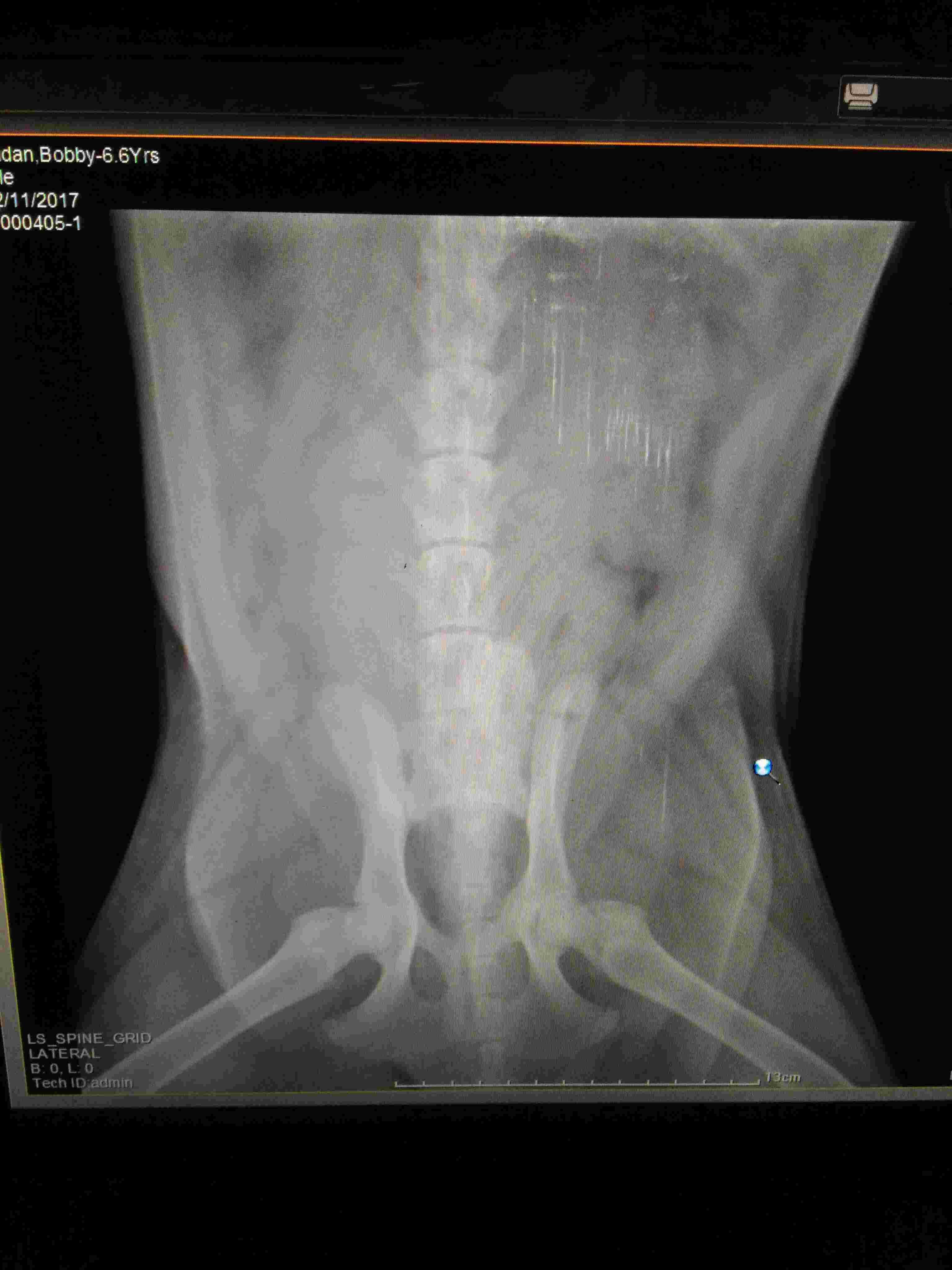 My dog fell, can't move back legs: What are treatment options? | Petco