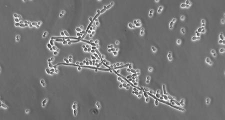 Candidiasis in Birds: Signs, Treatment & Prevention | Petco