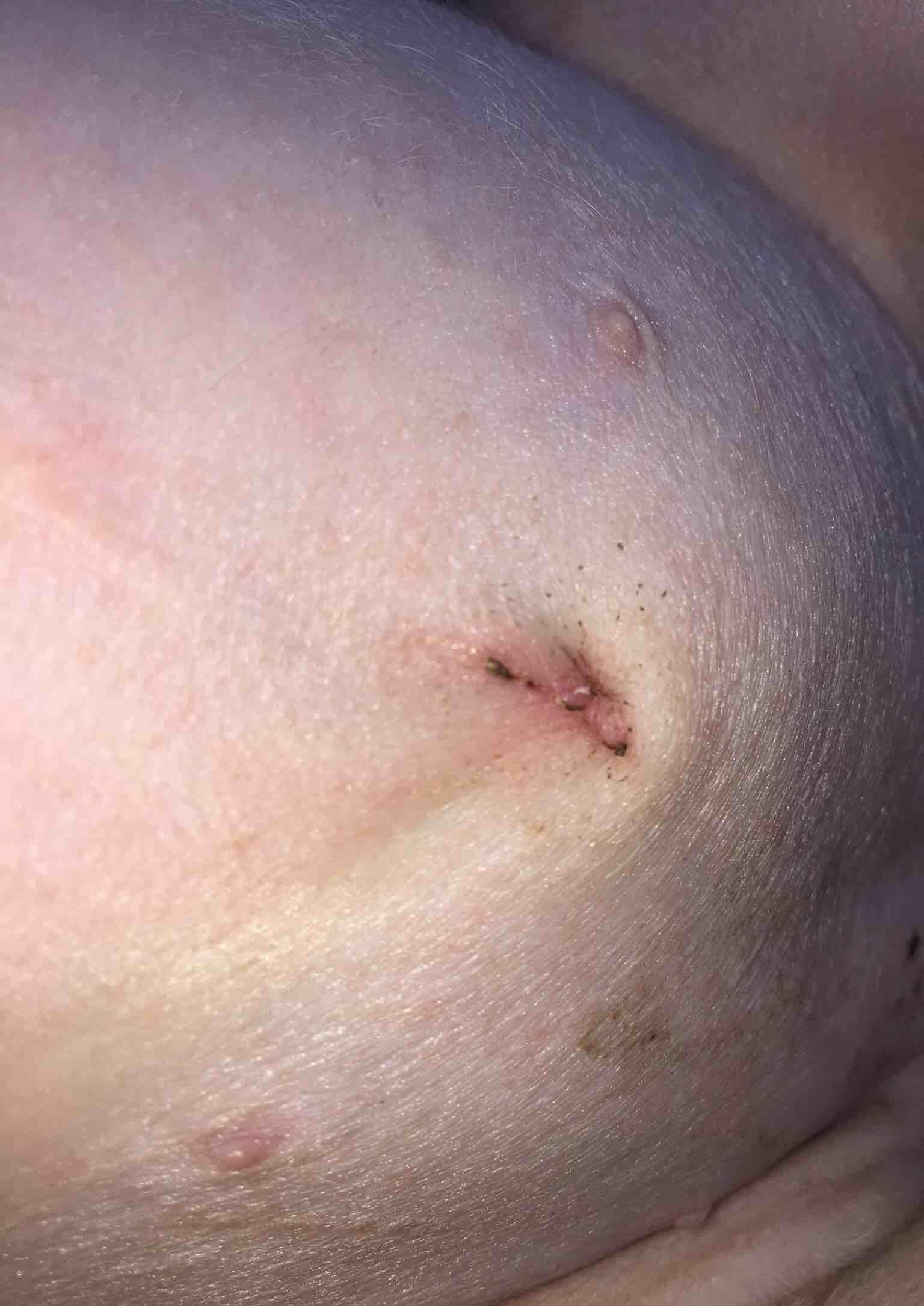 Signs Your 2-Month-Old Puppy's Spay Incision Healing Well | Petco