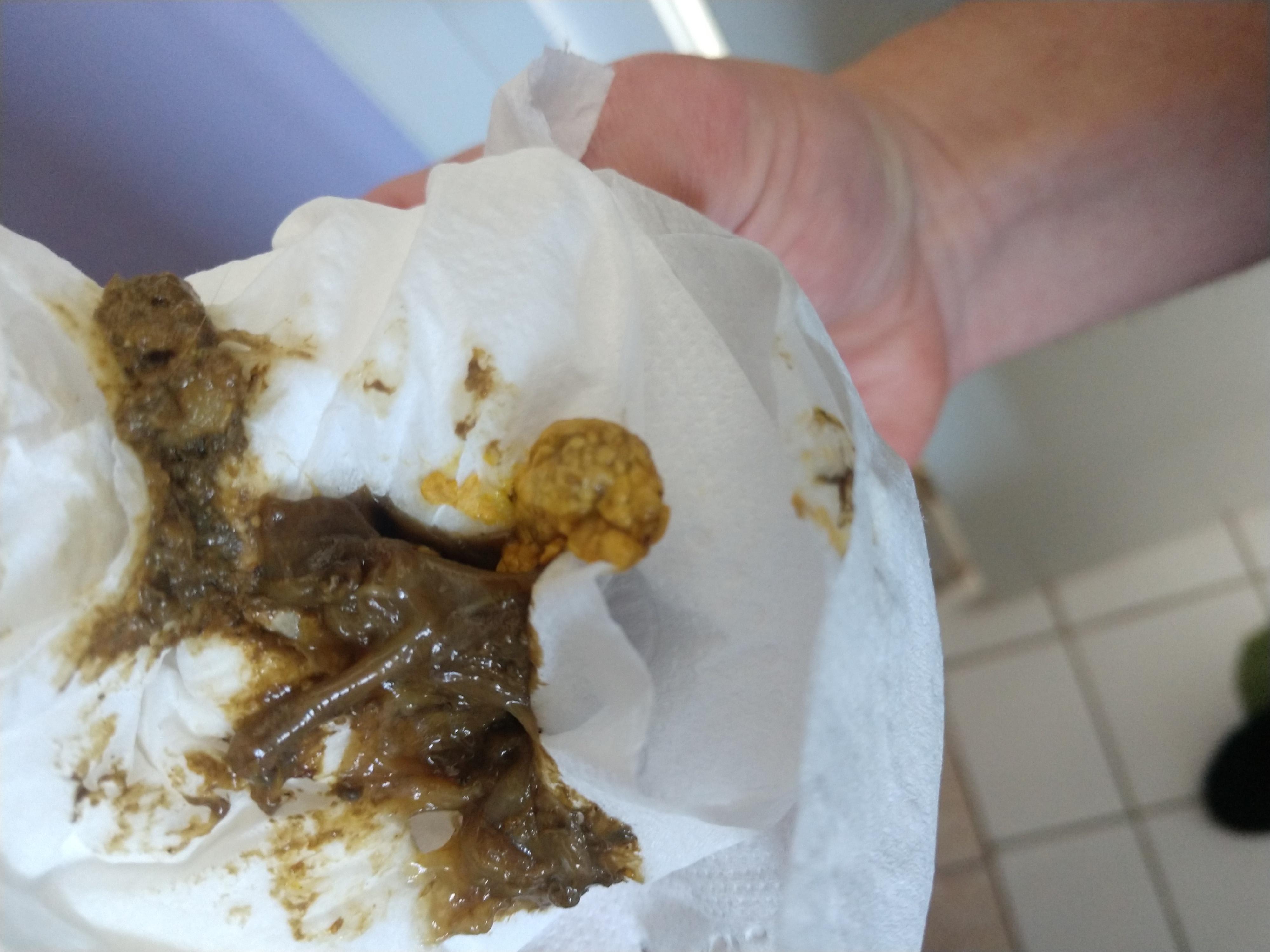 My dog has loose stool with goo & white clumps. Should I worry? | Petco