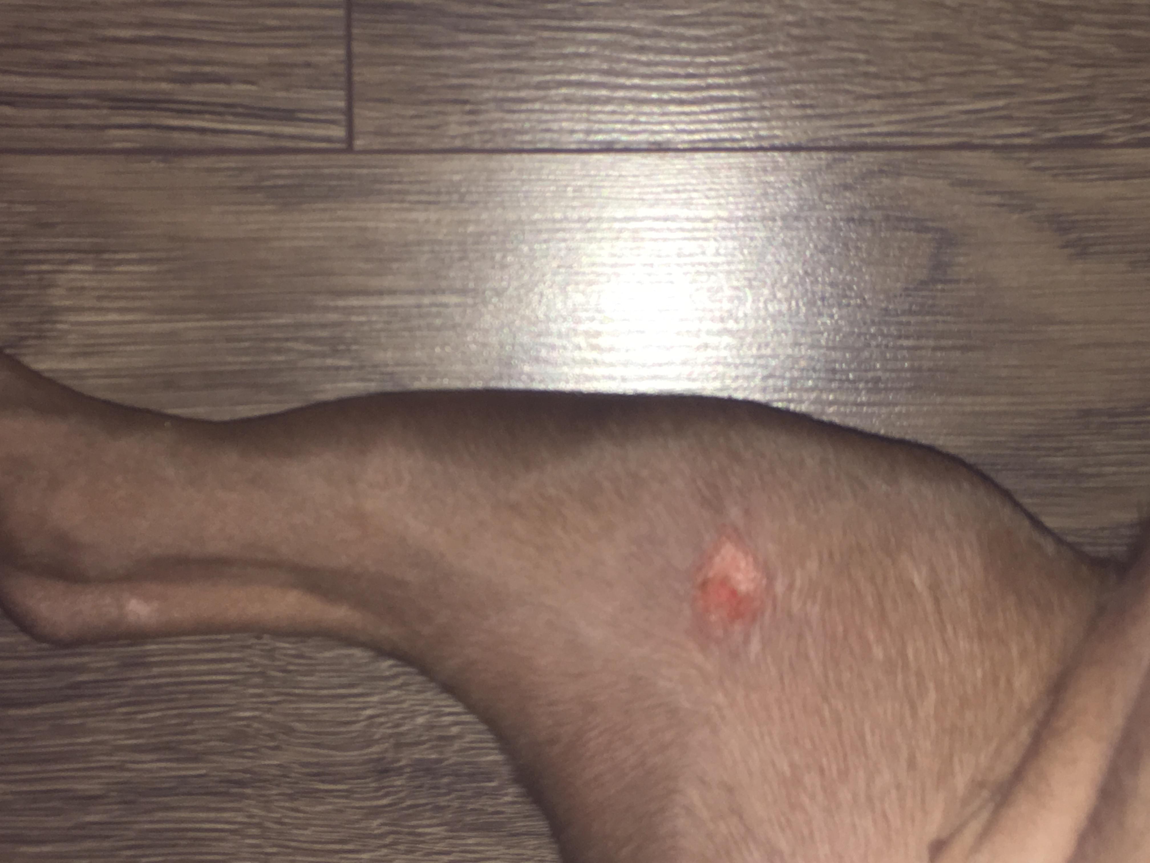 My Dog Has a Red, Circular Wound with Fur Loss: What Is It? | Petco