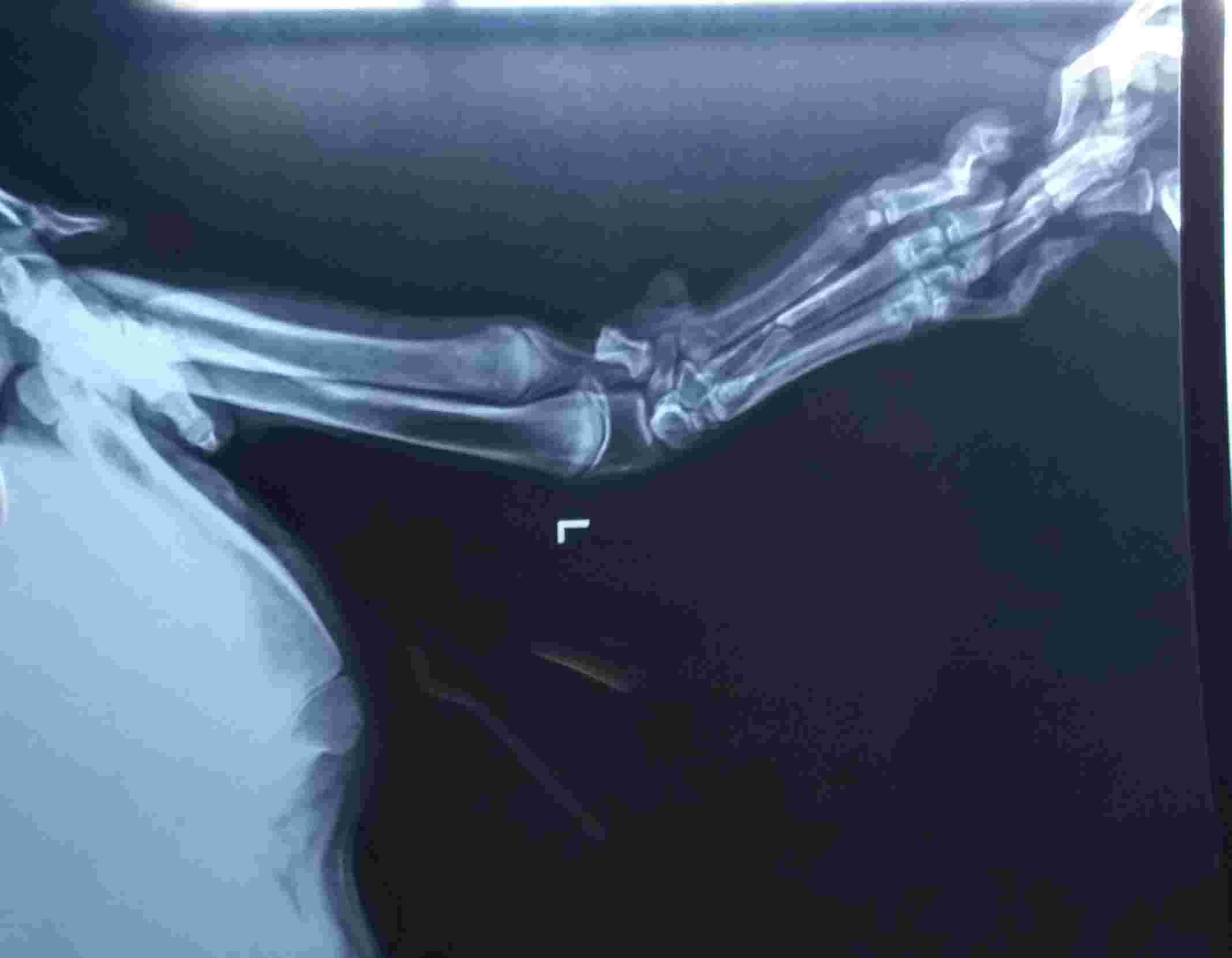 My Dog Has Carpal Valgus: Will Arthritis & Joint Issues Occur? | Petco