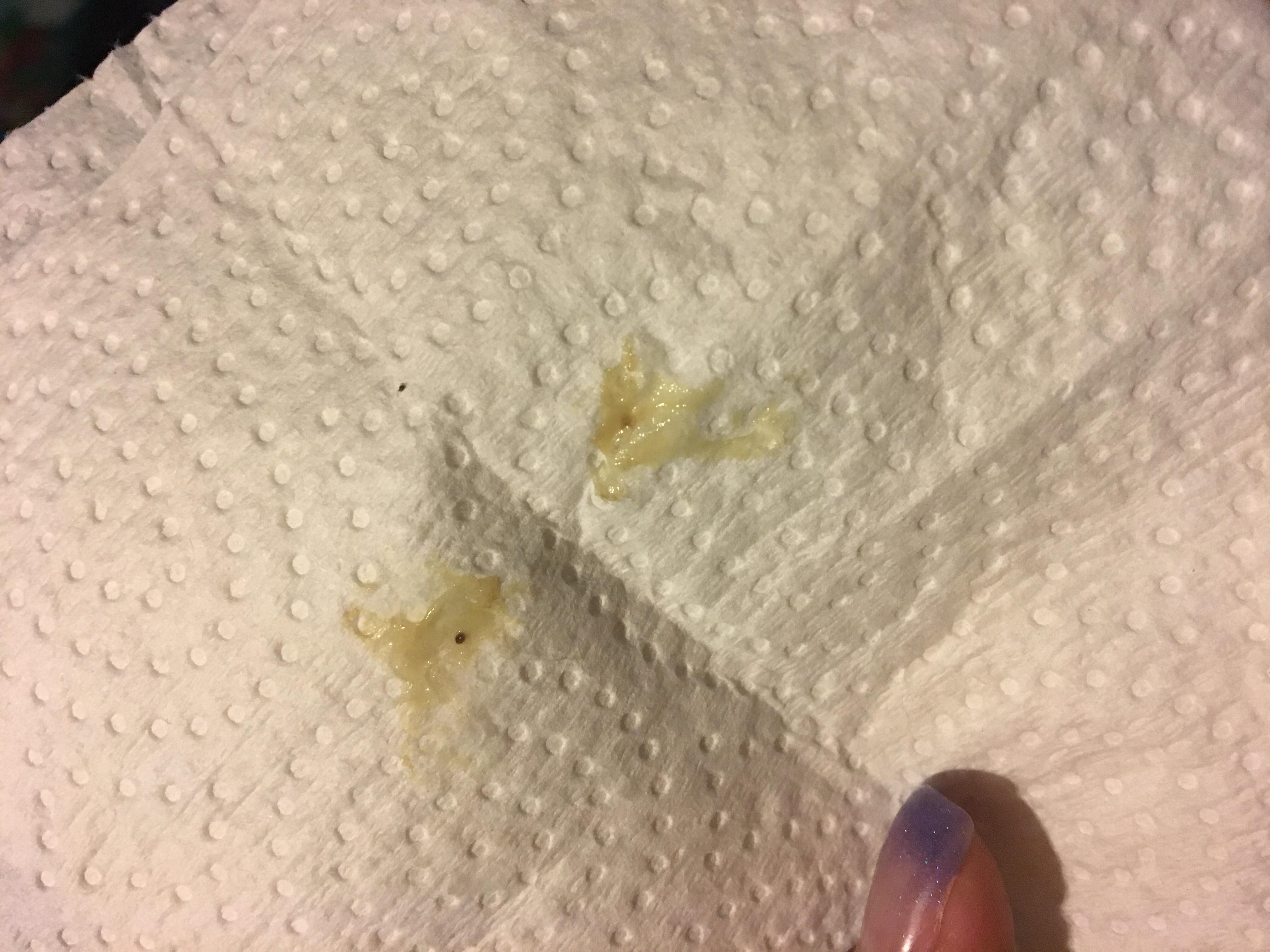 My pregnant cat has yellow discharge. Is it a mucus plug or worry? | Petco