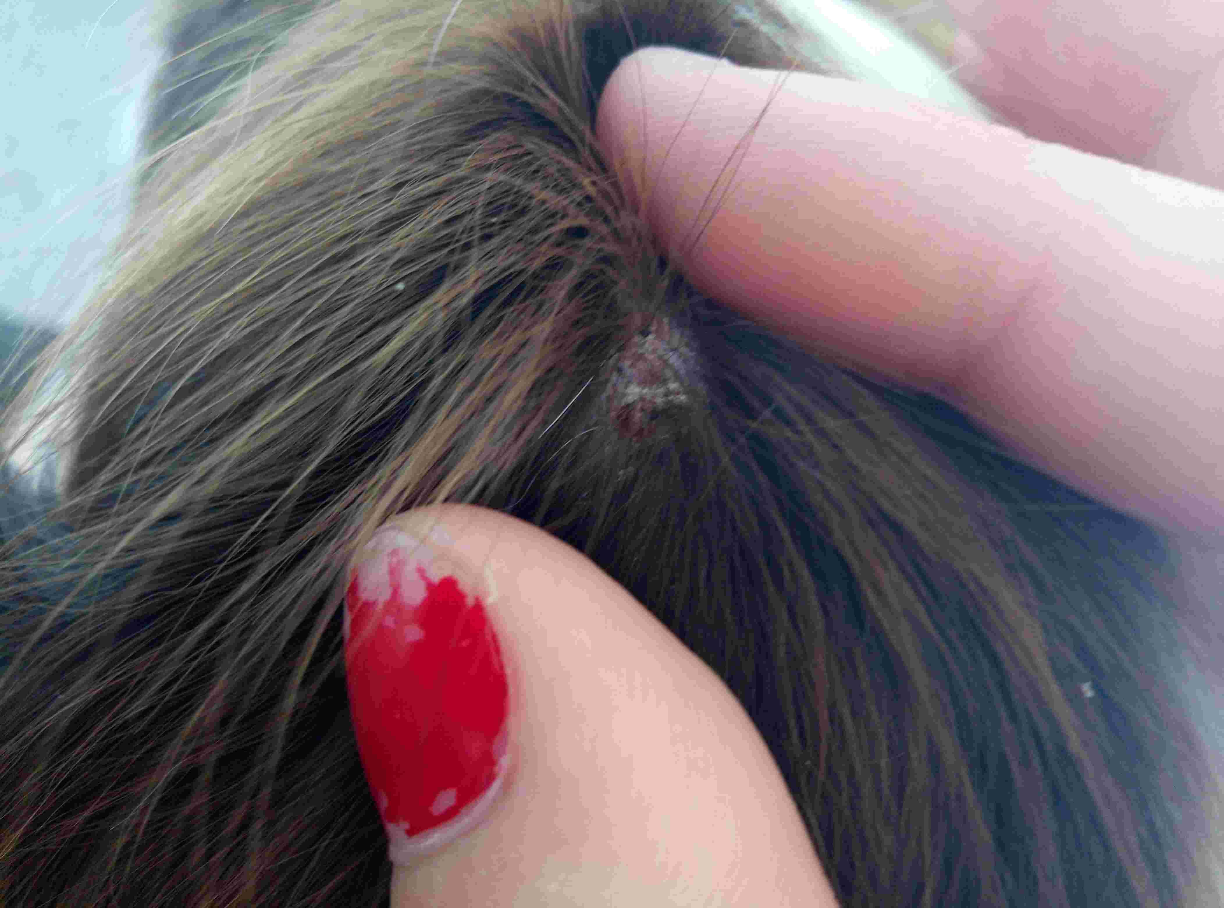 How to Tell if a Dog's Head Bump is a Tick or a Scab | Petco