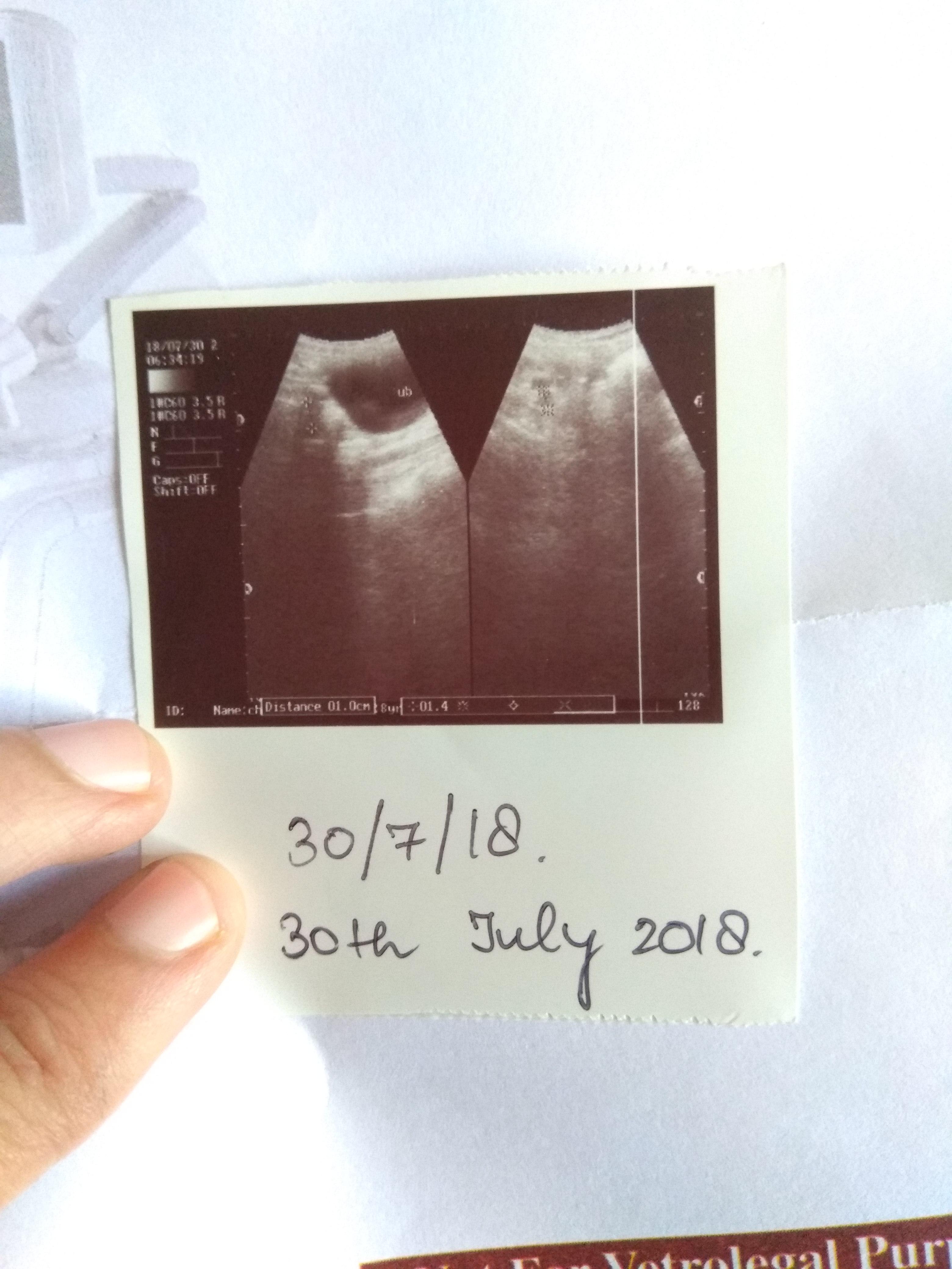 Dog Discharge: Could It Be Pyometra Despite Normal Behavior? | Petco