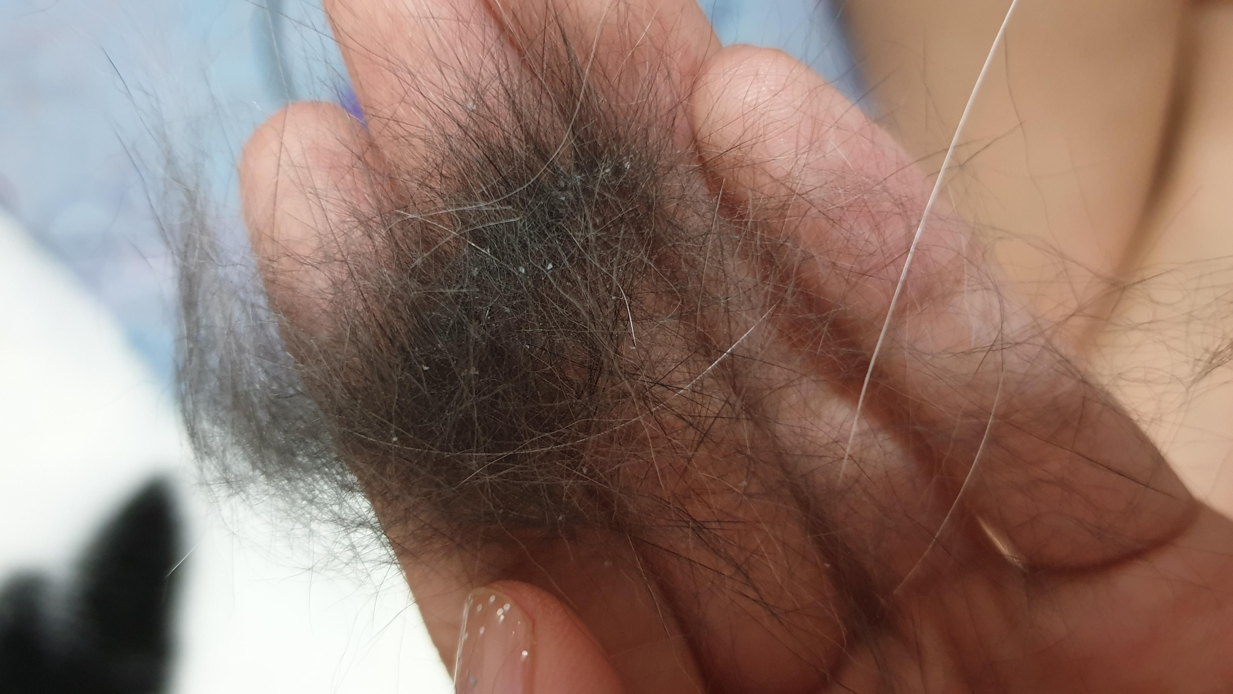 My Cat Has Balding Spots, Bleeding, Dandruff: Is it Ringworm? | Petco